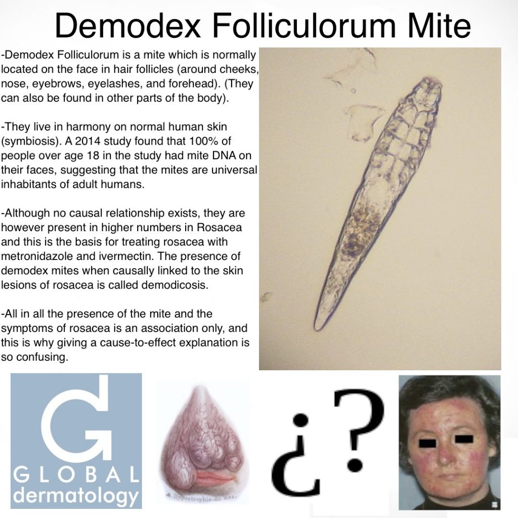 Global Dermatology » Demodex Folliculorum (mite) (Instagram)