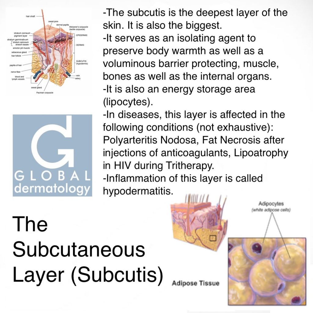 Global Dermatology » Subcutaneous Layer (Subcutis) (Instagram)